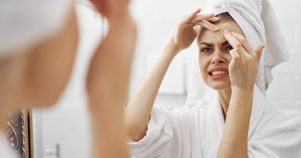 Как избавиться от прыща за один день? | theGirl