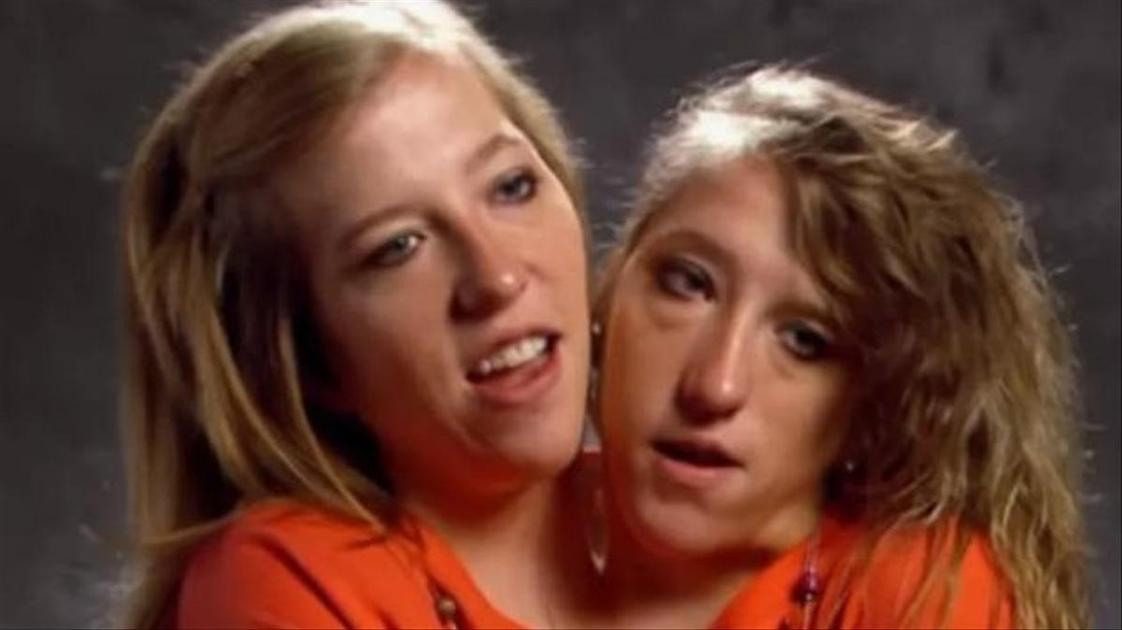 У сиамских близнецов Эбби и Бриттани Хенсел появился ребенок — первые фото | StarHit (СтарХит)