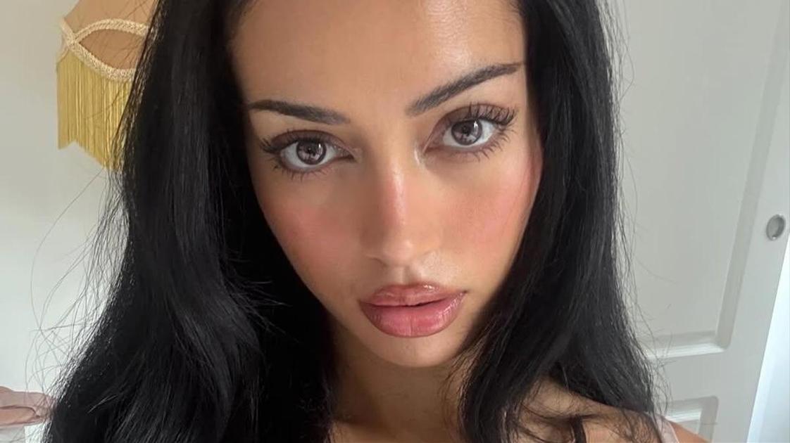 Baby Botox: кому он действительно нужен, когда начинать и почему это не ...