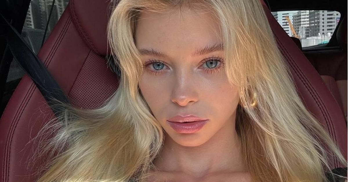 Пережившей инсульт Алле Брулетовой, известной как Bentley Girl, сделали операцию на сердце в ...