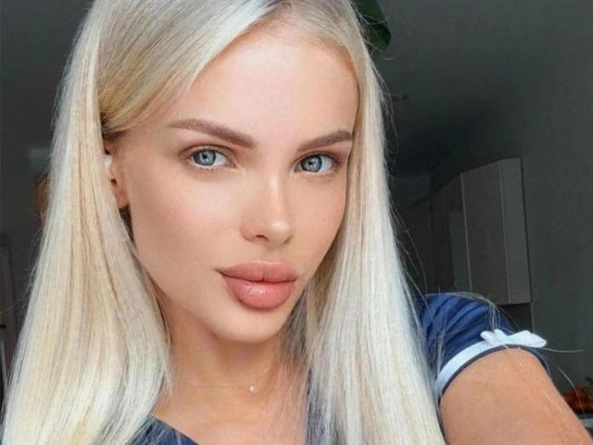 Что известно о возлюбленном лишившейся половины черепа модели Анжелики ...